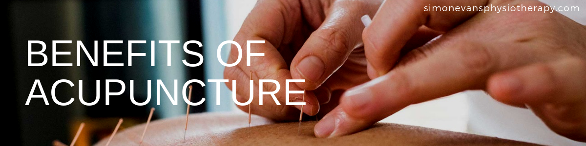 Benefits of Acupuncture – Simon Evans Physiotherapy